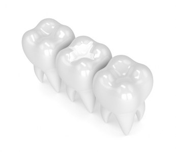 White Fillings - The Walden Dental Clinic in Saffron Walden